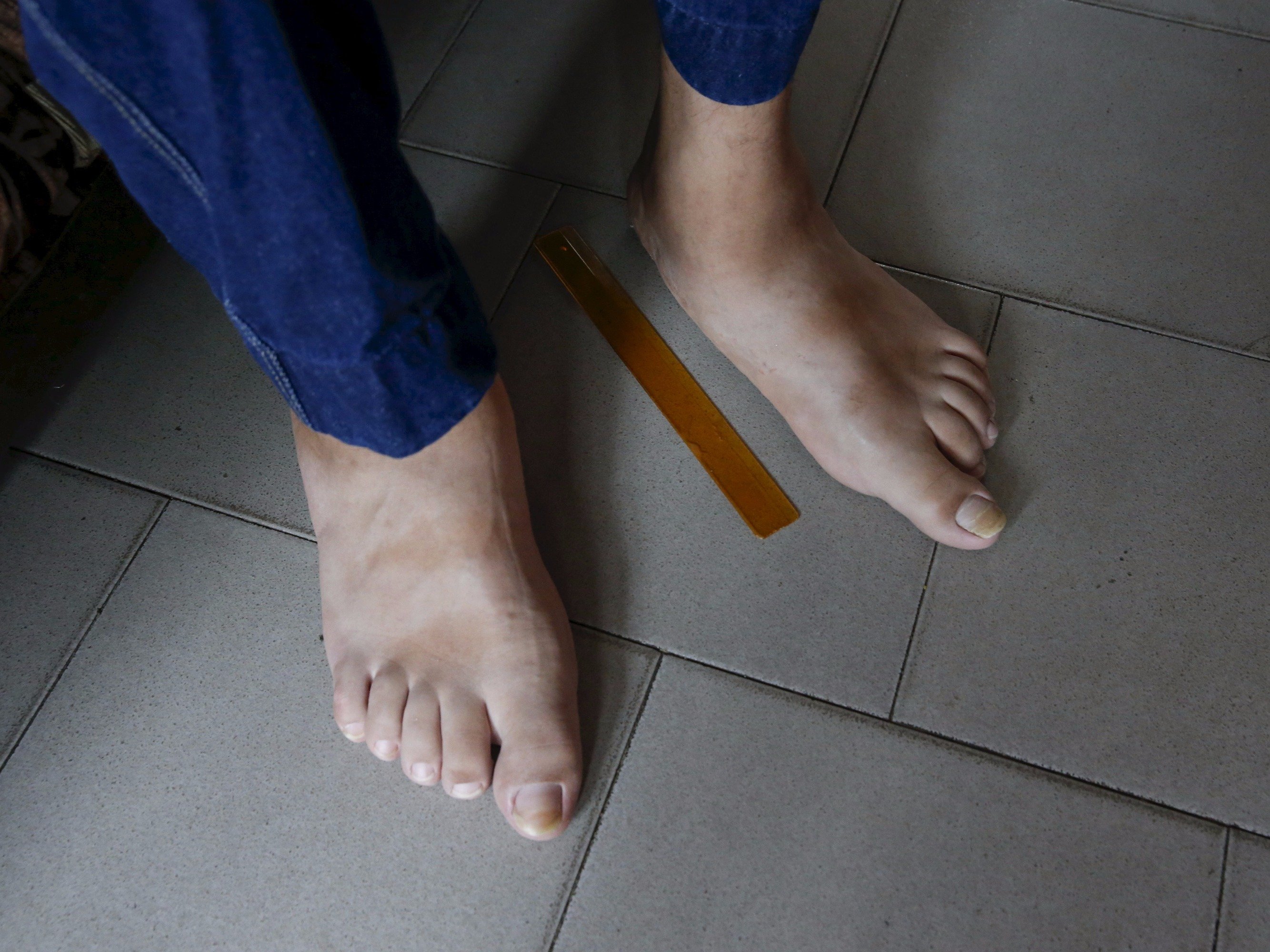 A 20-year-old Venezuelan Officially Has The Biggest Feet In the World ...